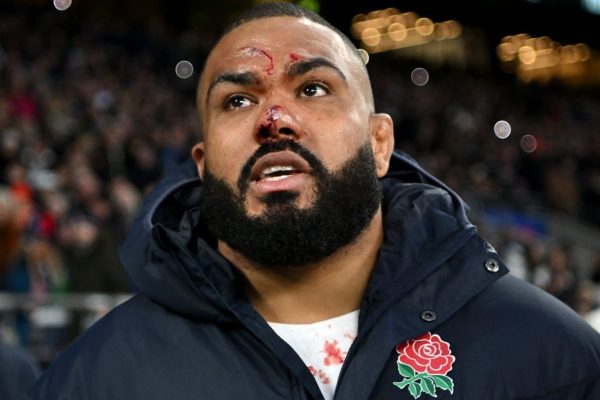 15 Most Common Injuries Seen on the Rugby Field - GulfPhysio - UAE's ...