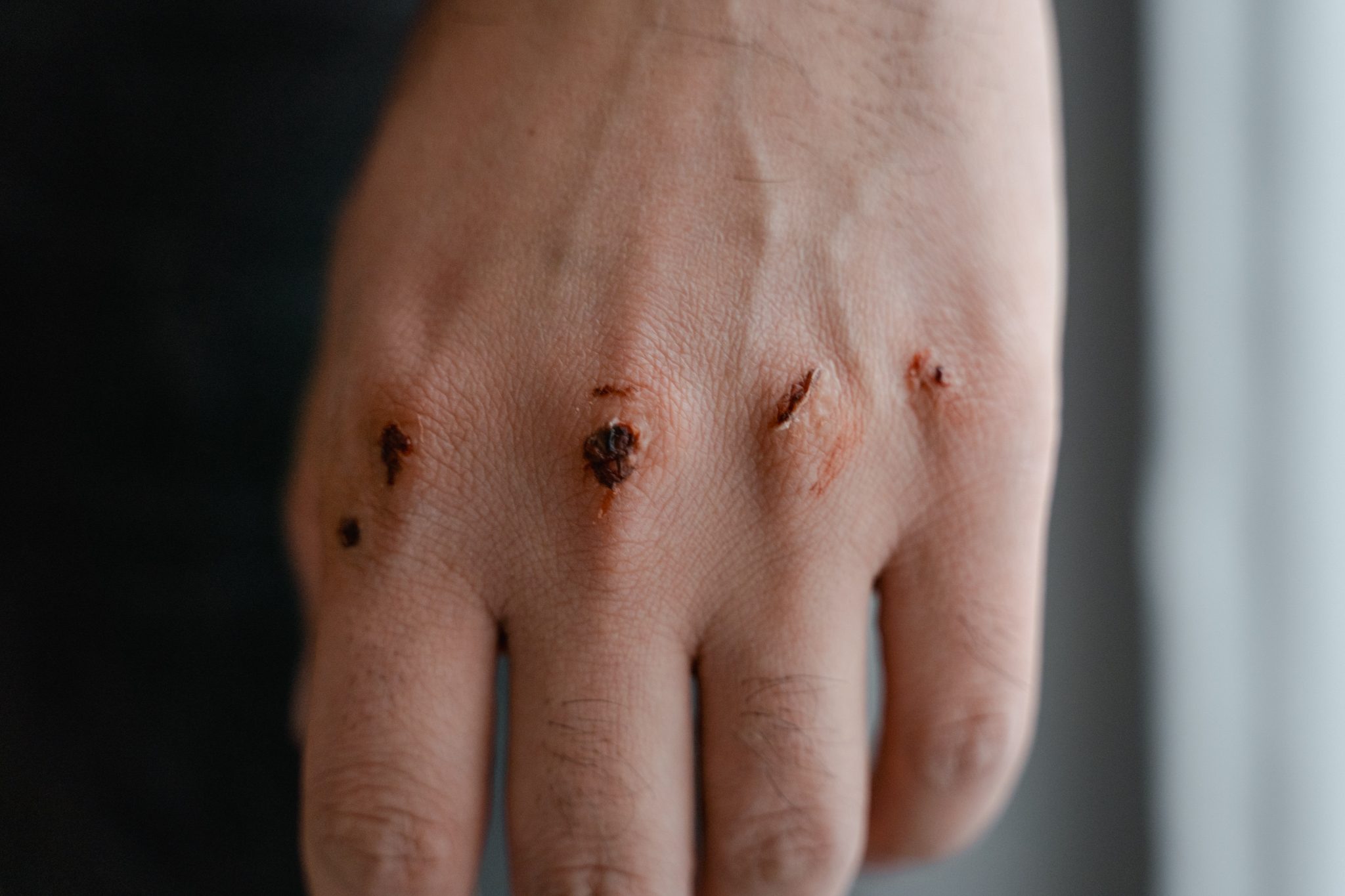 15 Most Common Injuries Seen on the Rugby Field - GulfPhysio - UAE's ...