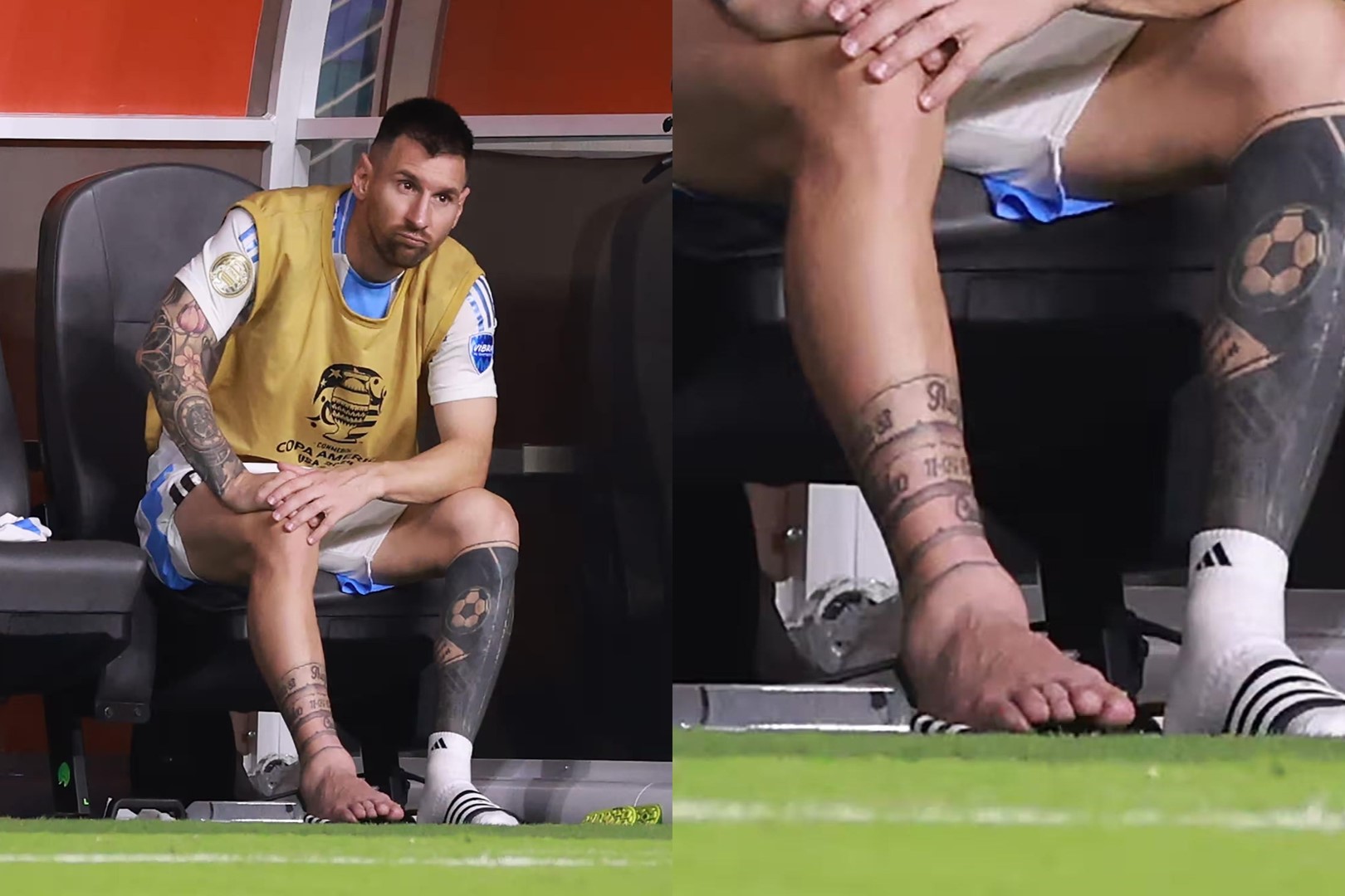 Learn From Messi: Ankle Injury Updates and Treatment Options ...
