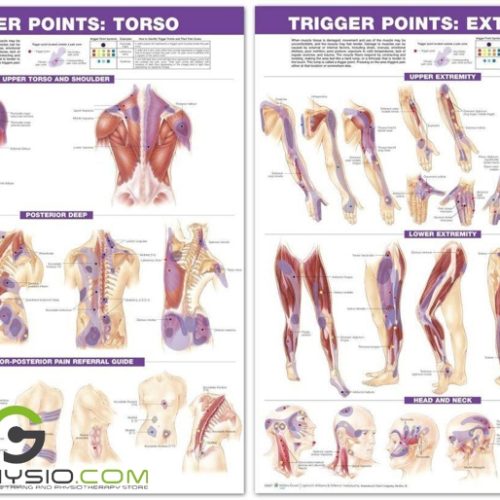 Trigger Points Chart (Set of 2) - GulfPhysio - UAE's Online ...