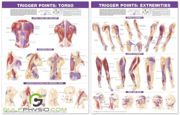 Trigger Points Chart (Set of 2) - GulfPhysio - UAE's Online ...