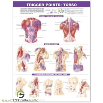 Trigger Points Chart (Set of 2) - GulfPhysio - UAE's Online Physiotherapy Store