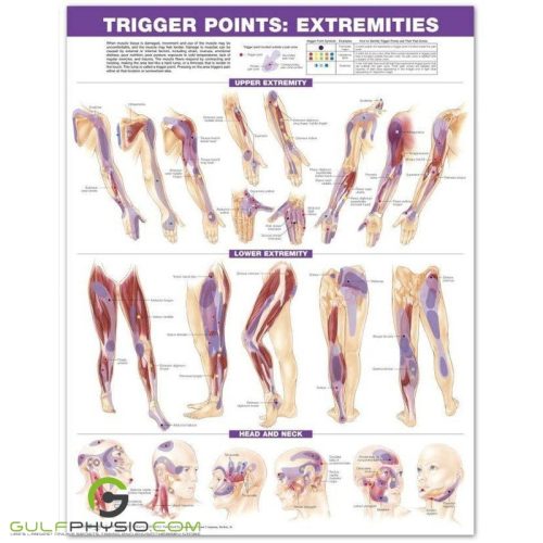 Trigger Points Chart (Set of 2) - GulfPhysio - UAE's Online ...