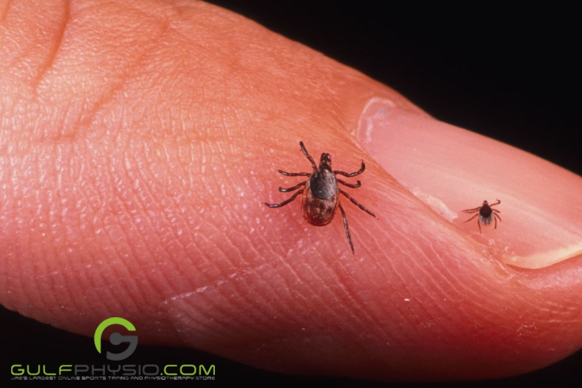 European Lyme Neuroborreliosis: Definitions, Diagnosis, & Management ...