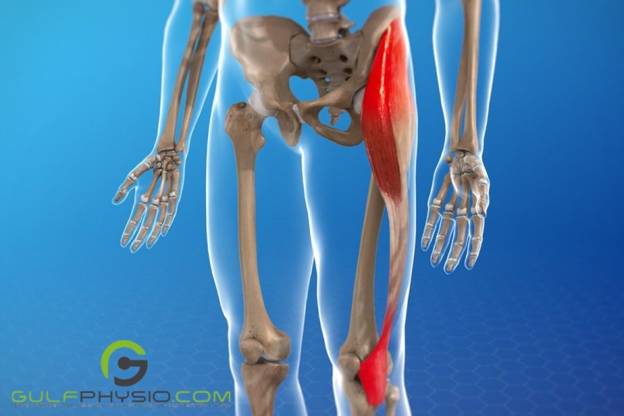 Iliotibial Band (ITB) Syndrome: Etiology, Anatomic Considerations and ...