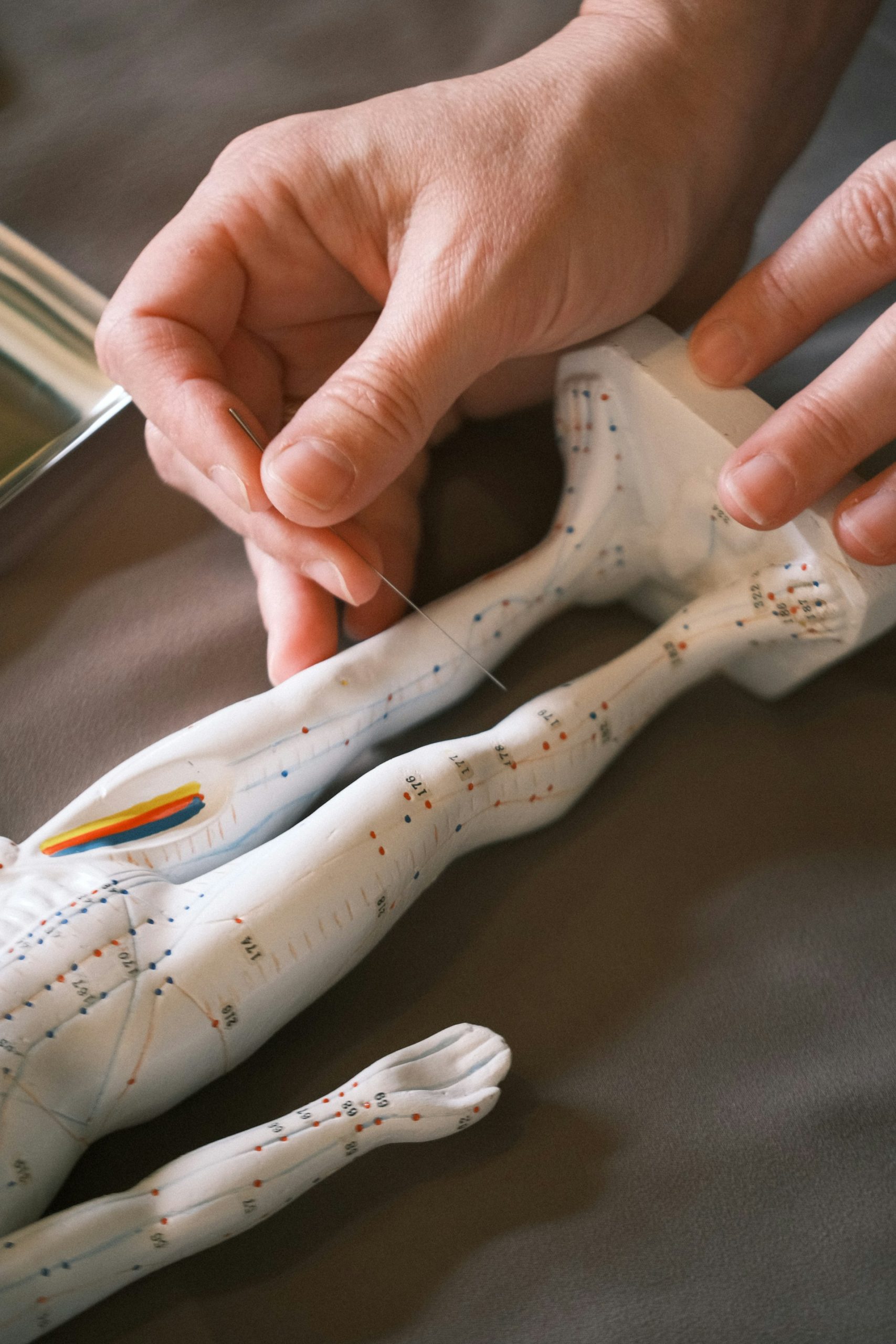 A Guide to the Rise of Acupuncture in the UAE - GulfPhysio - UAE's ...
