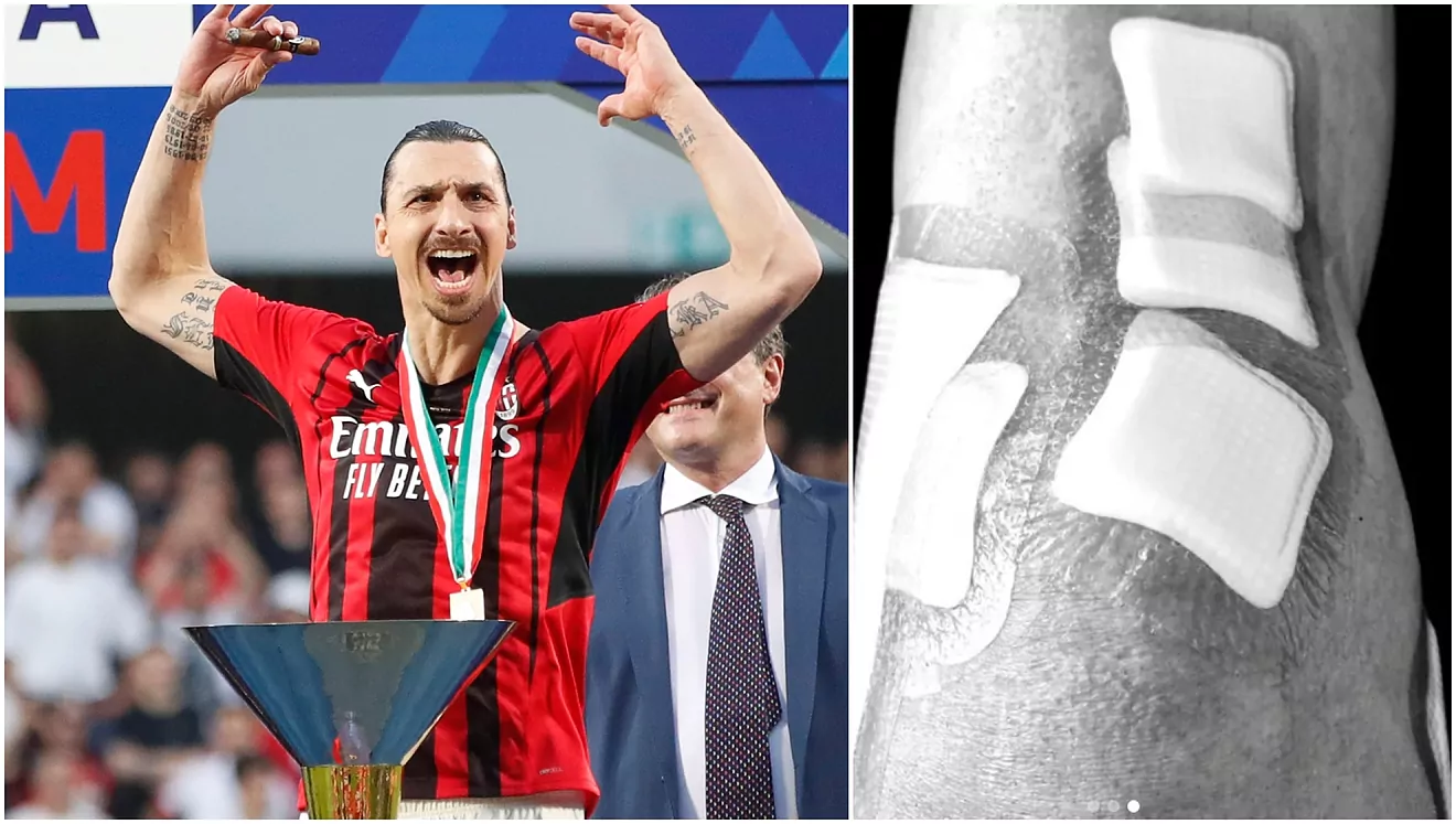 Zlatan Ibrahimovic’s ACL: A Deep Dive Into Knee Injuries in Football ...