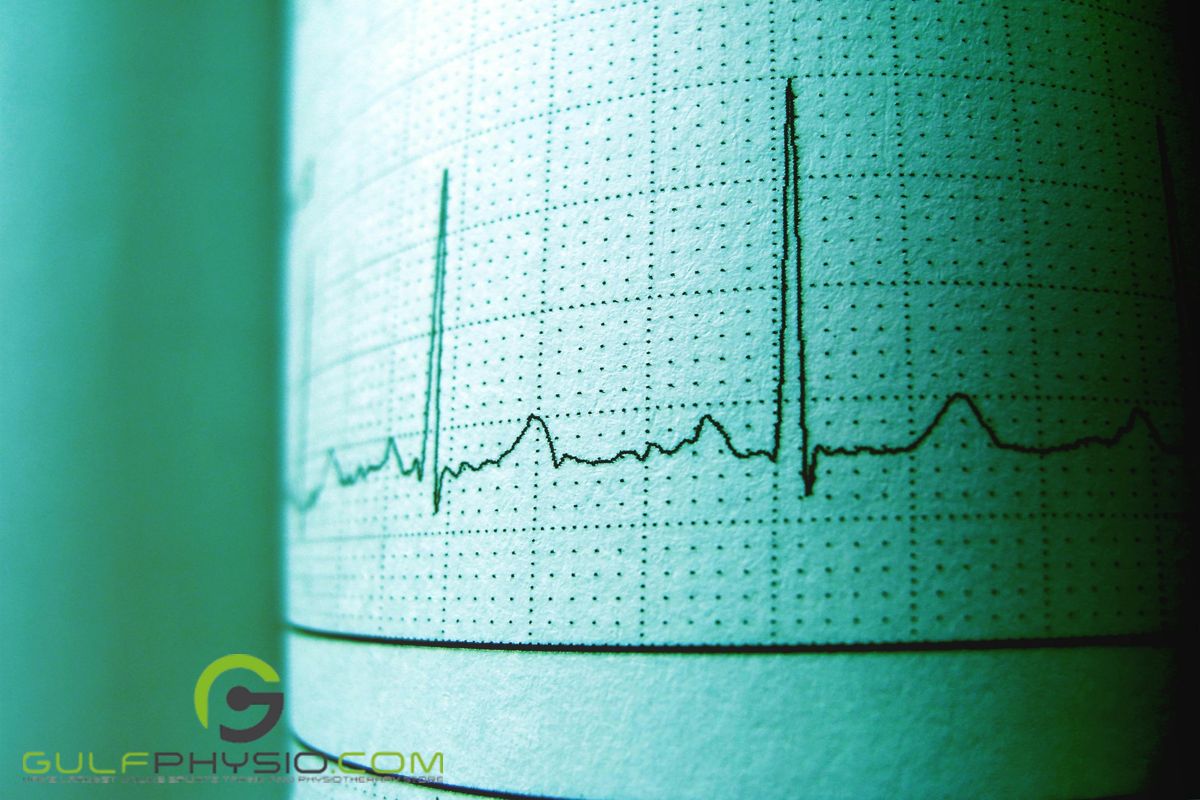 Cardiac Arrest Statistics Worldwide - GulfPhysio - UAE's Online ...